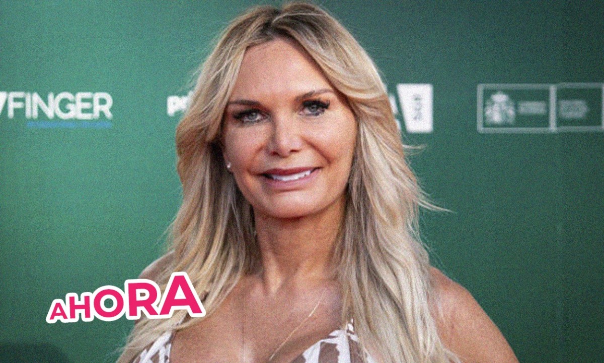 El impactante cambio de Yola Berrocal desde antes de someterse a ...